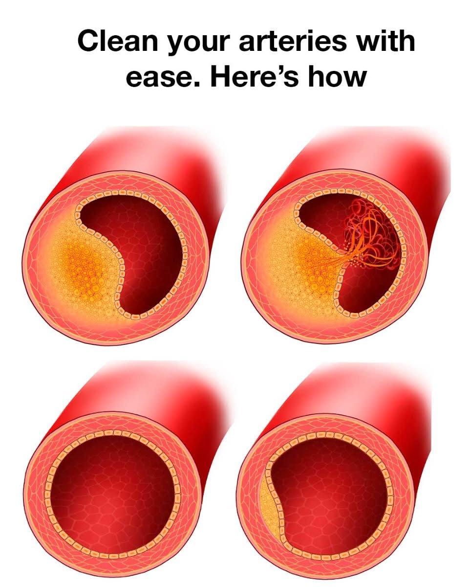 10 Foods That You Should Eat Daily For Clean Arteries.... - FAB Magazine