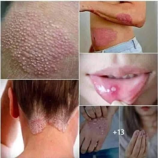 Signos del virus del papiloma humano que debes conocer - FAB Magazine